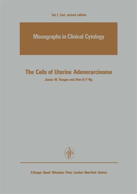 The Cells Of Uterine Adenocarcinoma Books Gateway Karger Publishers
