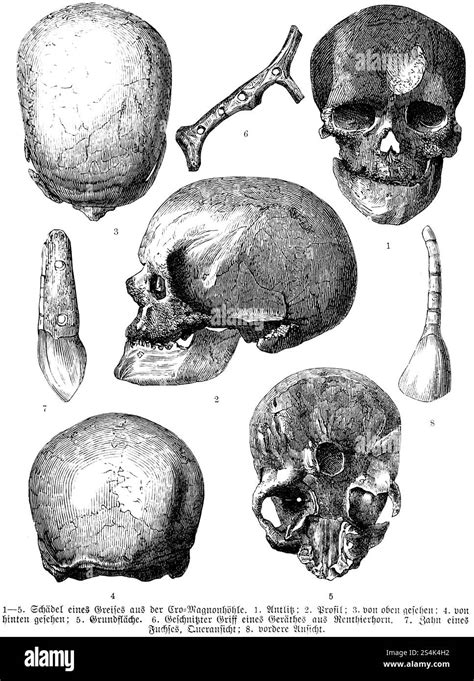 Skull From Various Archaeological Excavations In Profile And Front