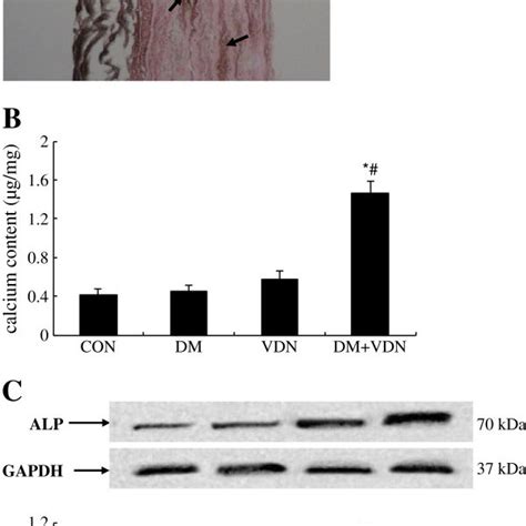 Diabetes Accelerated Rat Aorta Calcification A Von Kossa Staining