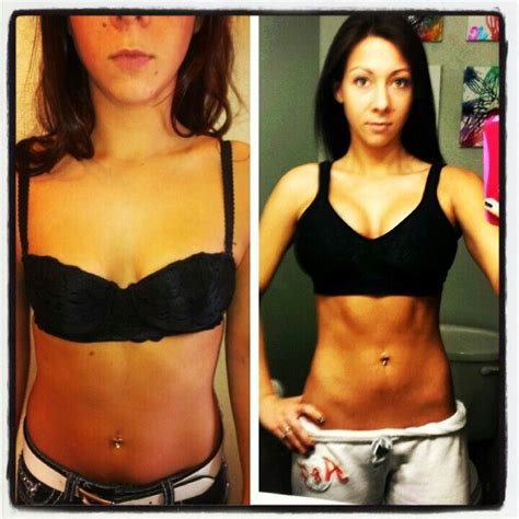 34 Ddd Breast Implants
