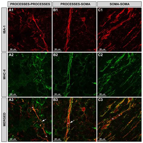 Rod Microglia Had Different Stages Of Cd68 Staining Iba 1 And Cd68