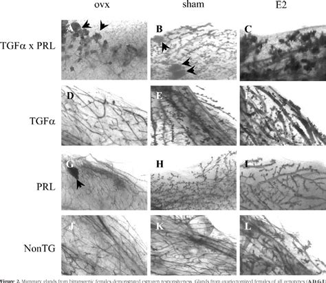 Figure 1 From Prolactingrowth Factor Crosstalk Reduces Mammary Estrogen Responsiveness Despite
