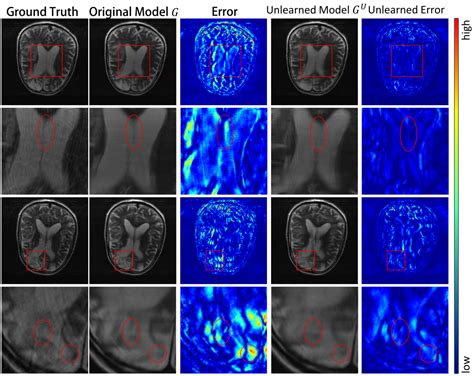 논문 리뷰 Erase To Enhance Data Efficient Machine Unlearning In Mri Reconstruction