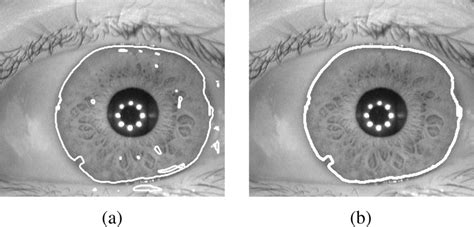 Final Contour Segmenting The Iris A Geodesic Contour Splitting At Download Scientific