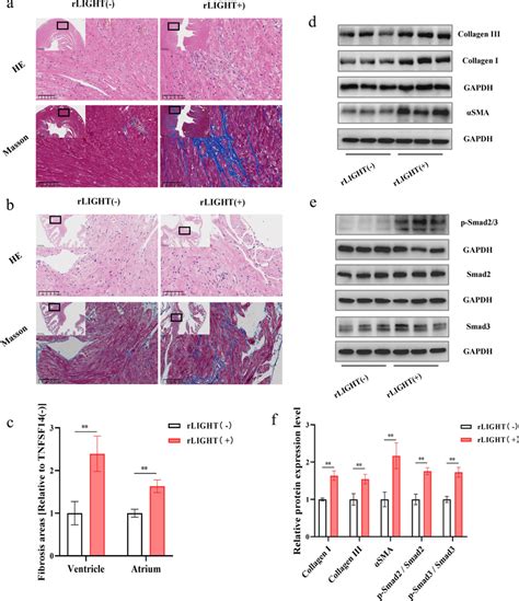 Light Contributes To Myocardial Fibrosis A Typical Histological Images