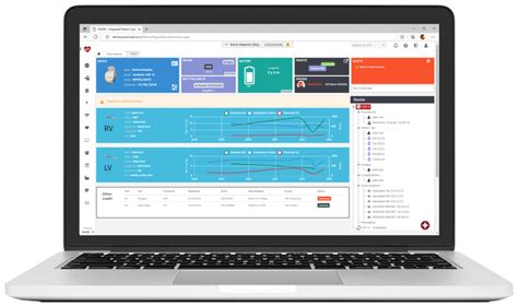 Ekora® Cardiology Department And Device Management