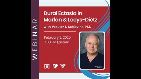 Dural Ectasia In Marfan And Loeys Dietz Syndrome With Dr Wouter Schievink Youtube