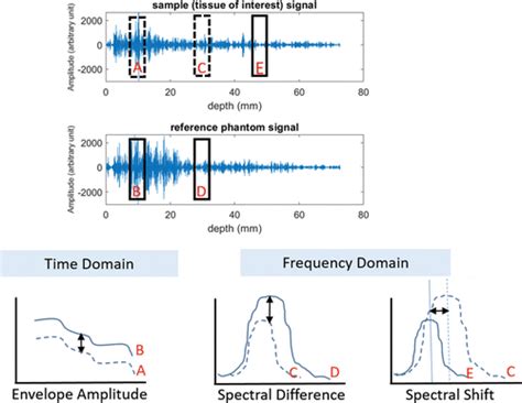 Us Attenuation For Liver Fat Quantification An Aium Rsna Qiba Pulse