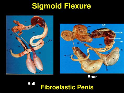Sigmoid Flexure Bull