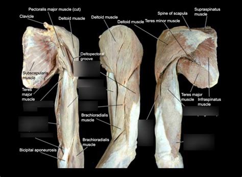Arm Muscles Biceps Brachii 14 Diagram Quizlet