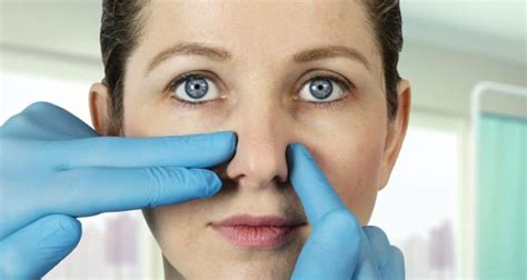 Best Sleep Position For Deviated Septum Our Comprehensive Guide