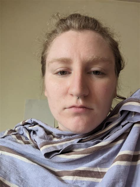 Season Help Rosacea Rcoloranalysis