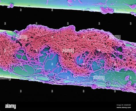 Used Toothbrush Bristles Coloured Scanning Electron Micrograph Sem