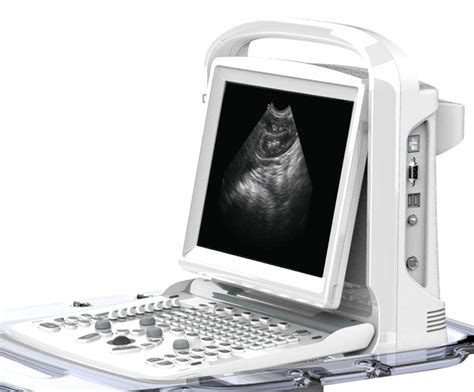 Chison Eco3 Msk Tendon Vascular Blackwhite Ultrasound Machine And Li