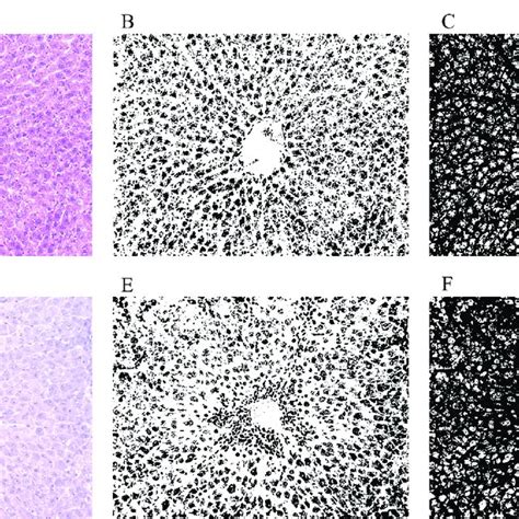 Steps In Graphic Processing Of The Classical Liver Lobule Stained With