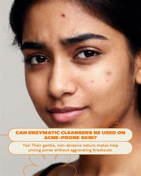 Best Sunscreen For Pimple Skin Care World Of Asaya