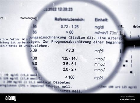 Result Of A Blood Test Haemogram View With A Loupe Reference Area