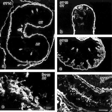 Gist With Spindle Cell Features Ob 10 × Download Scientific Diagram