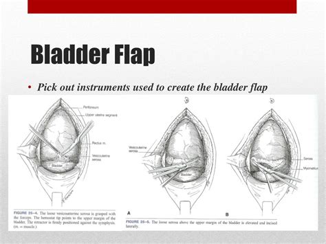 Ppt C Section Technique Powerpoint Presentation Free Download Id 2968375
