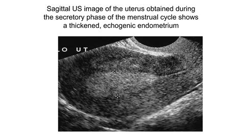 Imaging In Gynaecology Pptx