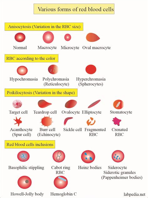 مورفولوژی‌ غیر طبیعی Rbc درگاه علوم پزشکی ایران مدلاین