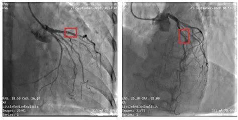 Aifactory Federatedlearning Fl Ai Aiealth Hpc Supercomputing