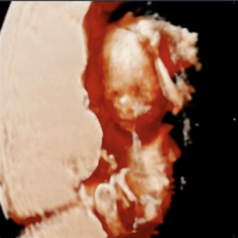 임신일기 16주차 일상기록 성별 확정 🩷 입덧 끝물 😙 네이버 블로그