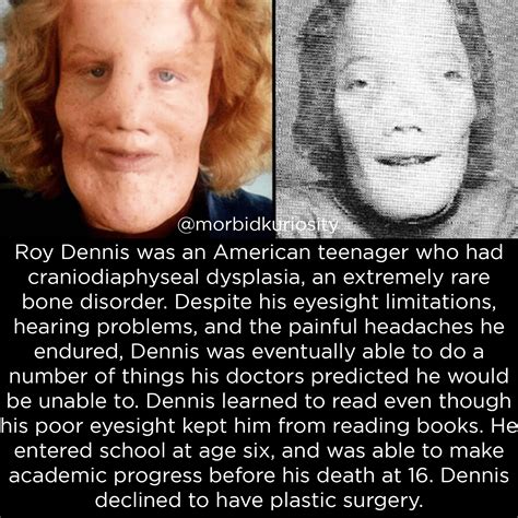 Rocky Dennis Real Life