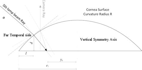 Figure 2 From Parameterization Of Limbus Distance In Van Herick Method