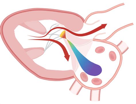 Mastering Esi Triage Your Guide To Effective Patient Care
