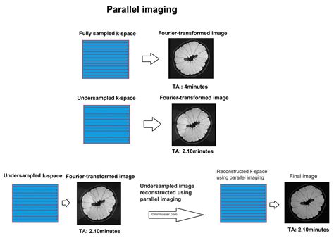 Mri Parallel Imaging Grappa Mri