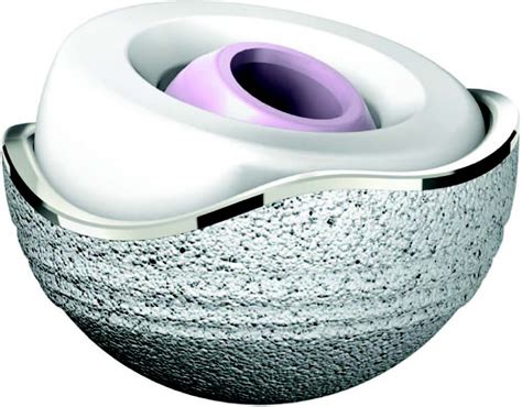 Hip Dual Mobility Total Hip Arthroplasty Should Everyone Get One William Blakeney