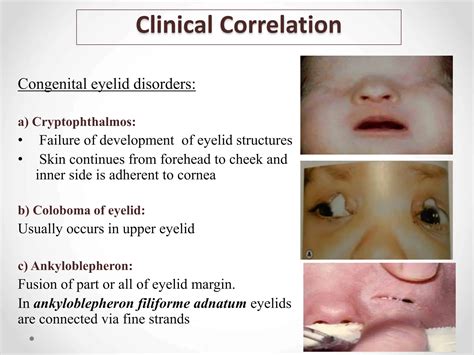 Anatomy Of Eyelid Introduction To Orbit Ppt
