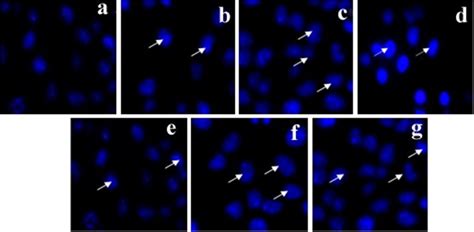 DAPI Apoptotic Analysis Of Treated Cells A Control Cells Bd Compound Download Scientific