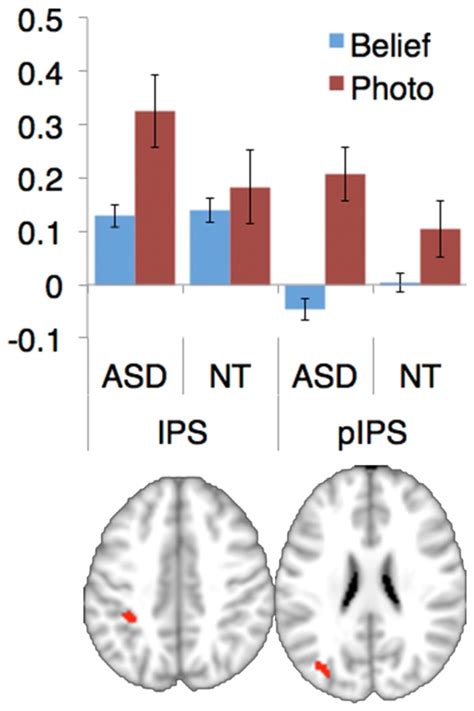 Two Clusters Both In The Intraparietal Sulcus Ips Were Found To Be Download Scientific