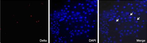 Immunostaining With Delta Red And Nuclear Staining Dapi Blue The