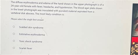 Solved The Diffuse Erythroderma And Edema Of The Hand Shown