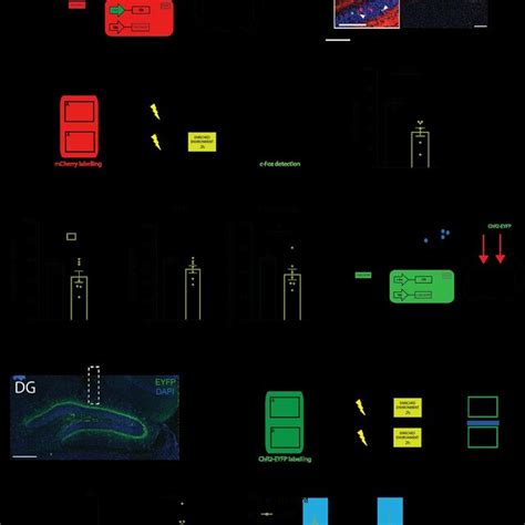 Retroactive Interference Causes Memory Impairment And Drives The