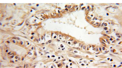 Rtn4 Nogo Rabbit Polyclonal Antibody