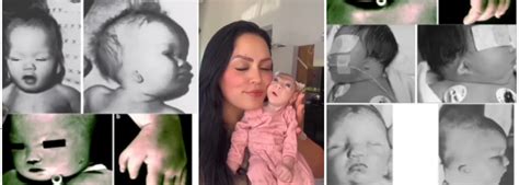 What Happens If You Get Pregnant On Accutane Health And Me