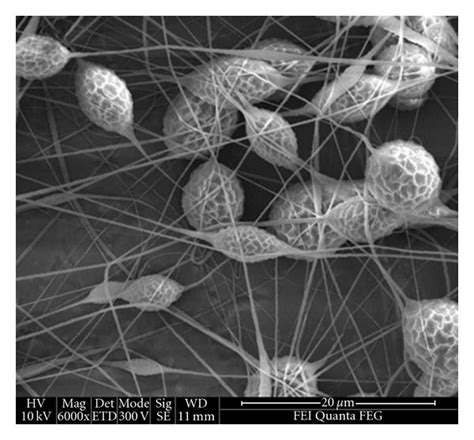 Bead Formation Definition At Indiana Mulquin Blog