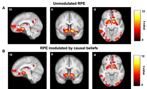 Reward Prediction Errors Group Level Statistical Maps From Glm 1 A