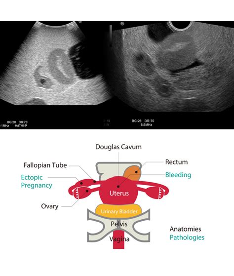 Female Pelvic Ultrasound Phantom 3 Units7w Us 10a Imaging Solutions