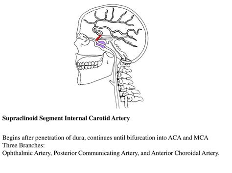 Towne Carotid Lateral Carotid 1 Internal Carotid 2 External Carotid 3