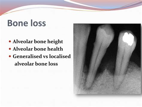 Parallel Angle Technique Vs Bisecting Angle Technique Pptx Dental Health Diseases And