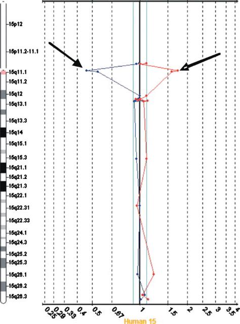 A Chromosome 15 Ratio Plot From Sample 18 Displaying A 2 Clone Deletion