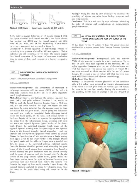 (PDF) Inguinofemoral lymph node dissection technique