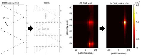 Correction And Optimization Of Symmetric Echo Planar Spectroscopic Imaging For Hyperpolarized [1
