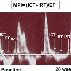 Myocardial Performance Index Download Table