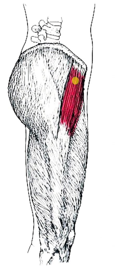 Tensor Fasciae Latae Trg Zone44